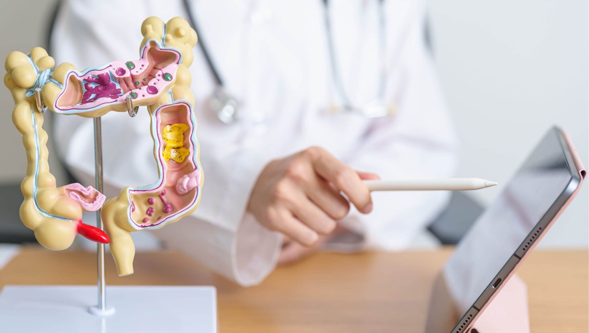 Alternative Colon Cancer Treatment Options | Sunridge